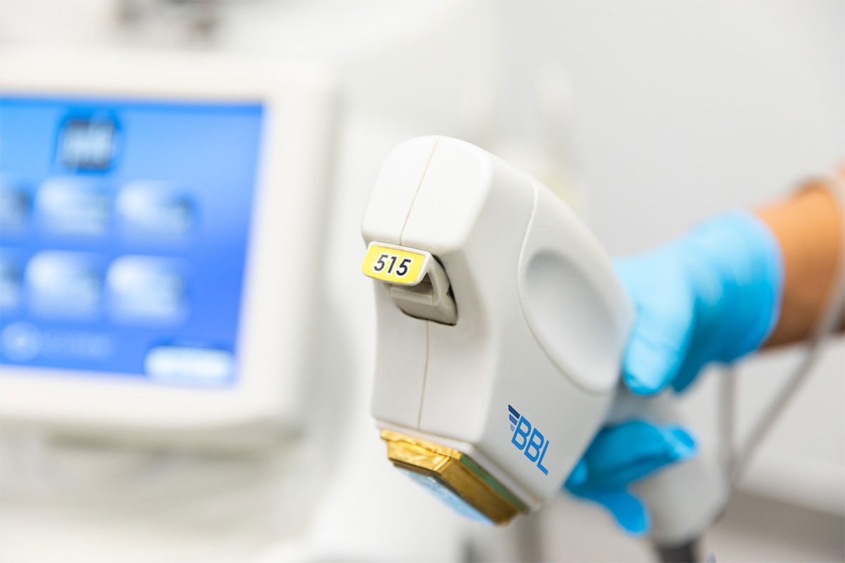 IPL Photofacial with BBL HEROic in Westford, MA | Rejuv Med Spa